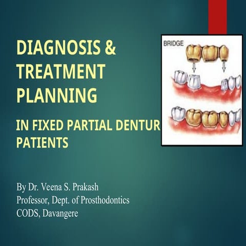 Diagnosis & Treatment Planning in Fixed Partial Denture | PPT