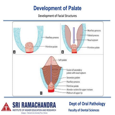 Diagrams for Practicals- Devpt of Palate.pptx | Dental Health ...