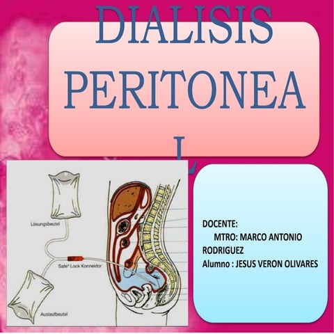 dialisis-peritoneal jesus veron.ppt5x1561561 | PPT
