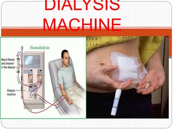 HEMODIALYSIS MACHINE | PPT