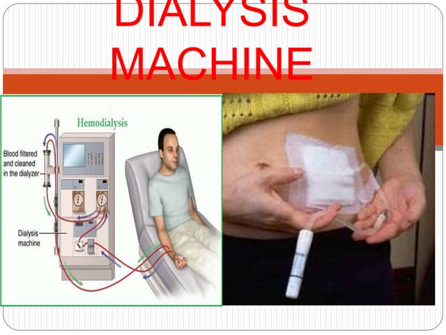 Nursing Care of Patient on Dialysis | PPTX