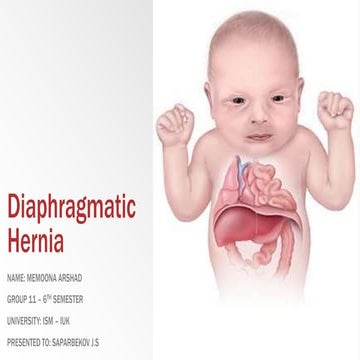 Diaphragmatic hernia | PPT