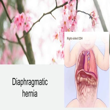 diaphragmatic hernia chn bsc nursing 5 sem.pptx