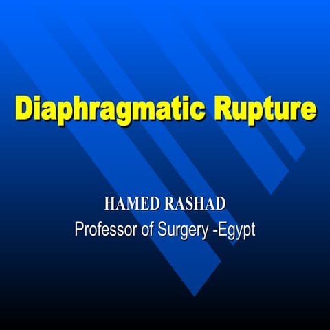 Imaging of diaphragm and its pathologies by Dr. Milan | PPTX