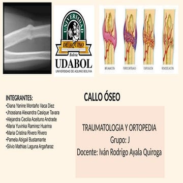 TRAUMATOLOGIA CAPITULO 5 CALLOS OSEOS callo oseo.pptx