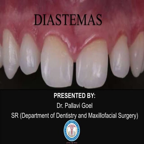 Diastemas | PPTX
