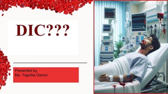 Disseminated intravascular coagulation (dic) | PPT