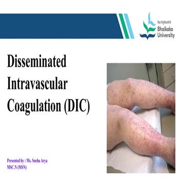 Disseminated intravascular coagulation ppt | PPTX