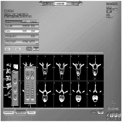 DICOM surgery workstation - wireframe | PDF