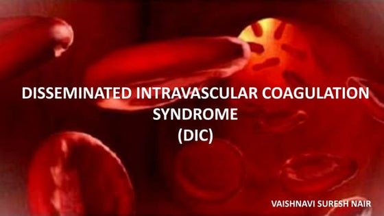 DISSEMNATED INTRAVASCULAR COAGULATION(DIC).pptx
