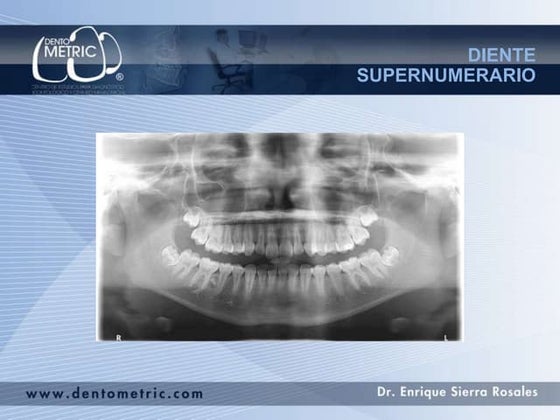 Radiologia dental en ninos | PPT