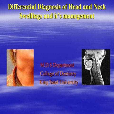 Differential diagnosis of head and neck swelling | PPT