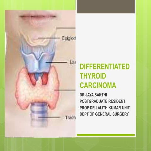 Differentiated thyroid carcinoma | PPT