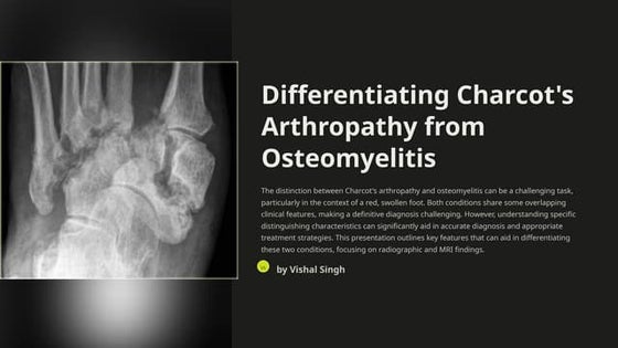 CHARCOT ARTHROPATHY.pptx by Dr.Sivaji M.S | PPTX
