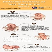 Different Position of your baby .pdf