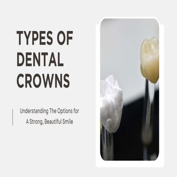 Understanding Different Type of Dental Crowns.pptx