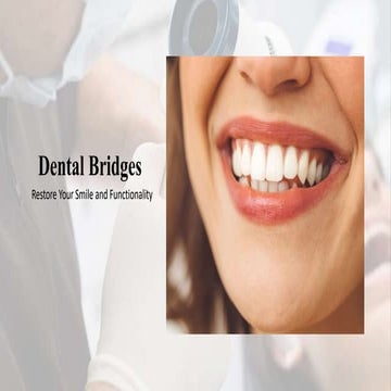 Different Types of Dental bridges - Green Valley Smile Care.pptx