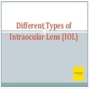Different Types of Intraocular Lenses in Cataract Surgery.pptx