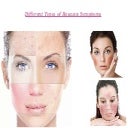 Different types of rosacea symptoms