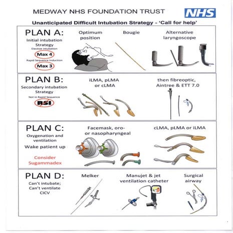 Difficult airway | PDF