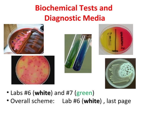 Gram negative rods