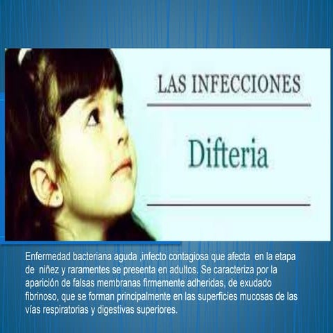 Difteria desde el punto de vista epidemiologico | PPTX