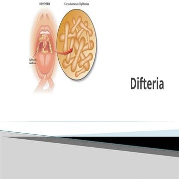 Enfermedad por Difteria_signos, sintomas y dx.pptx
