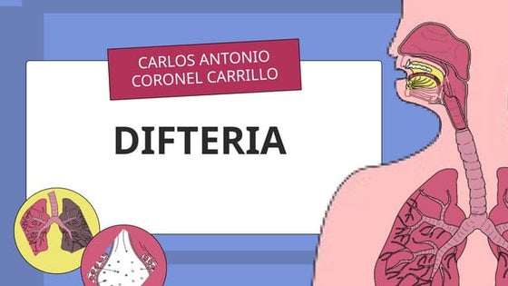 Tratamiento para Difteria.pdf