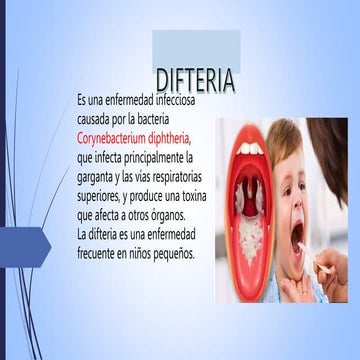 DIFTERIA (9).pptx