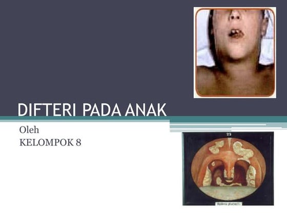 Dosis Obat Anti Tuberkulosis berdasarkan Berat badan | PPT