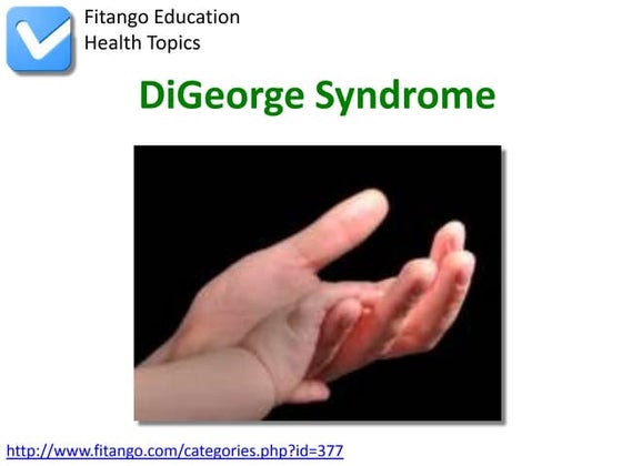 Digeorge syndrome | PPT
