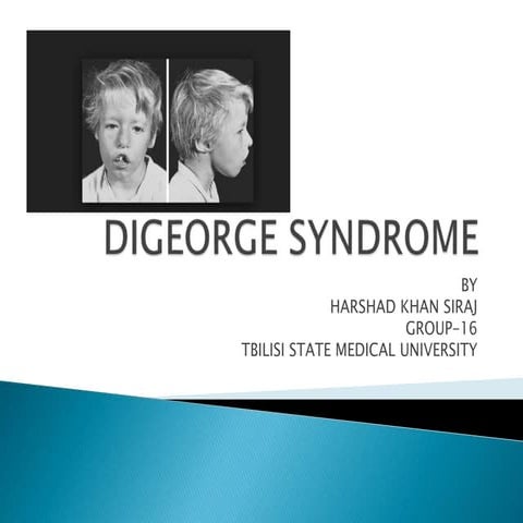 Digeorge syndrome | PPT
