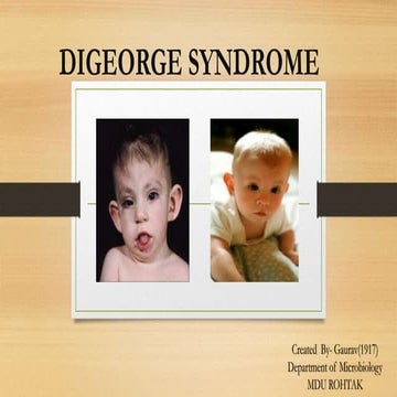 Digeorge syndrome | PPT