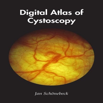 Digital atlas of cystoscopy.pdf