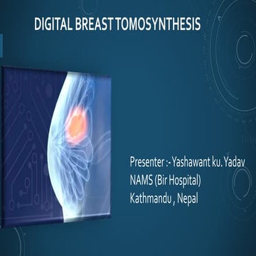Digital Breast Tomosynthesis Pptx Cancer Diseases And Conditions