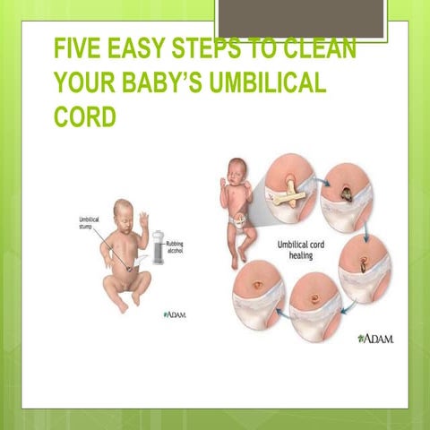 Digital story on cleaning the baby's umbilical cord | PPTX