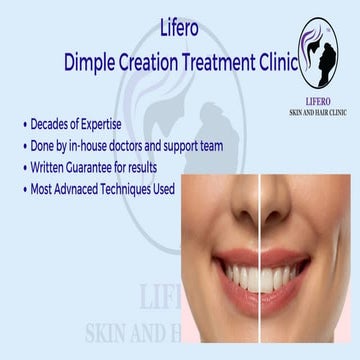Dimple Creation Treatment.pdf