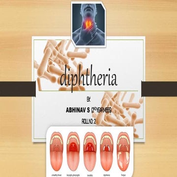 Diphtheria :- acute bacterial infection caused by Corynebacterium ...