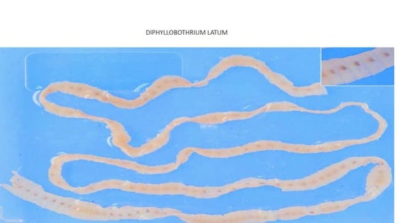 Diphyllobothrium latum | PPTX