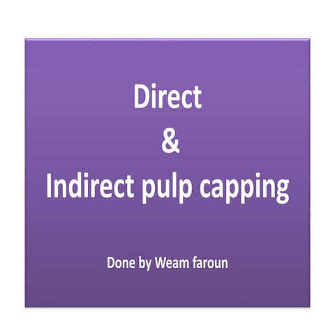 Direct and indirect pulp capping | PPTX