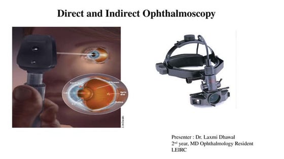 Direct ophthalmoscope | PPTX | Eye and Vision Conditions | Diseases and ...