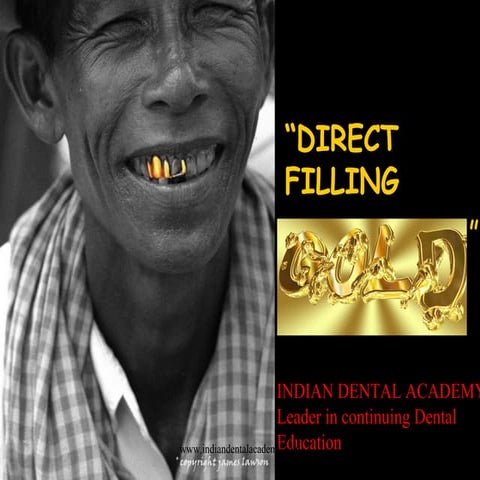Direct filling gold in dentistry /cosmetic dentistry courses | PPT ...
