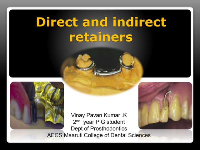 removable partial denture survey lines, path of insertion, guide planes ...