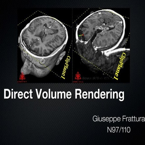 Direct volume rendering pres | PPT | 3-D Graphics | Computer Software and Applications