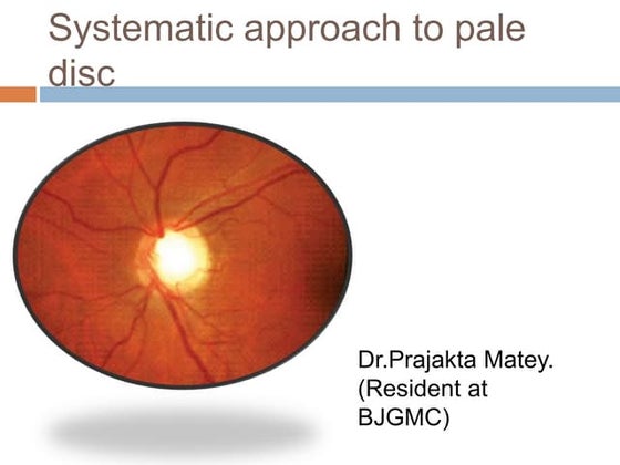 Approach to a pale optic disc | PPTX | Blood Disorders | Diseases and ...