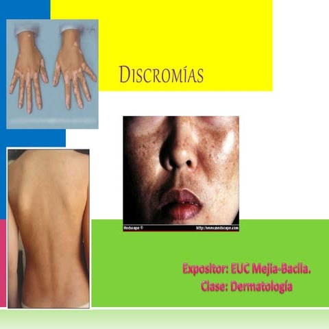 Discromias | PPTX