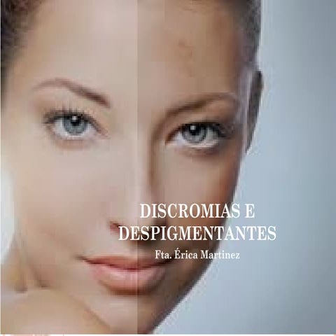 aula sobre Discromias e despigmentantes.pptx