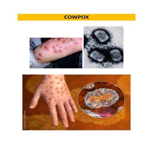DISEASES cowpox infections infectious.pdf