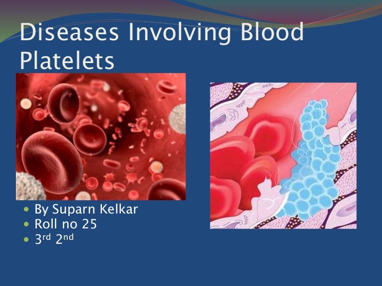 Platelets In Blood