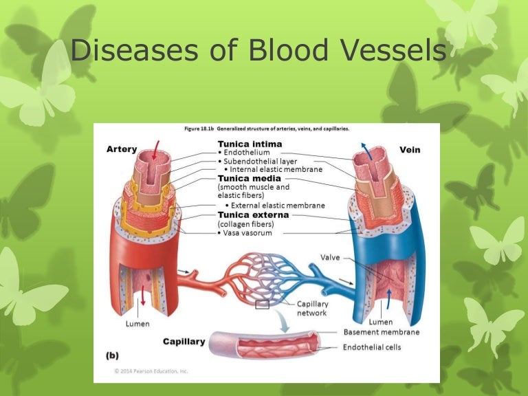 How To Reverse Blood Vessel Damage at Minnie Wilkin blog